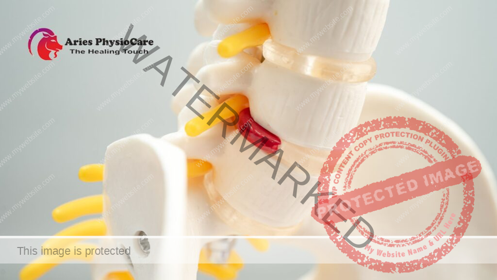 Non-Surgical Recovery From Back Pain With Disc Bulge: Advancements In ...